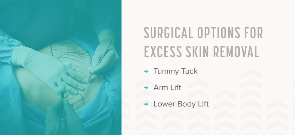 Read the Bariatric Blog | Get Answers & Next Steps